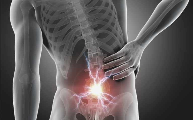 Inflammatory back pain explained. - Osteopathy in Dulwich